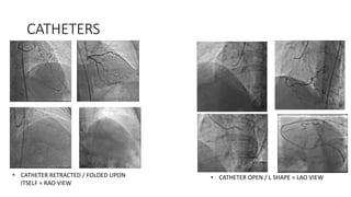 CORONARY ANGIOGRAPHY INTERPRET.pptx
