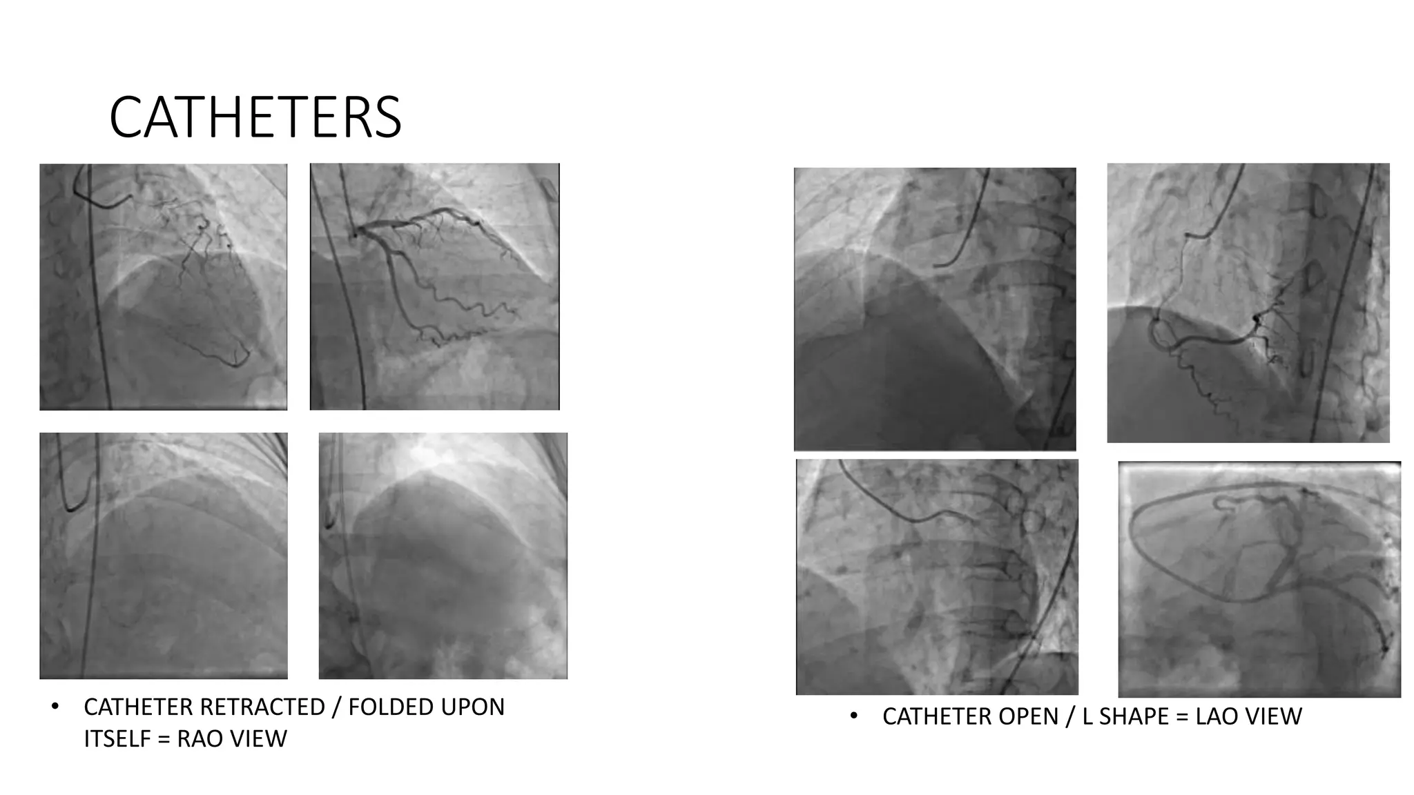 CORONARY ANGIOGRAPHY INTERPRET(Coronary Angios).pptx