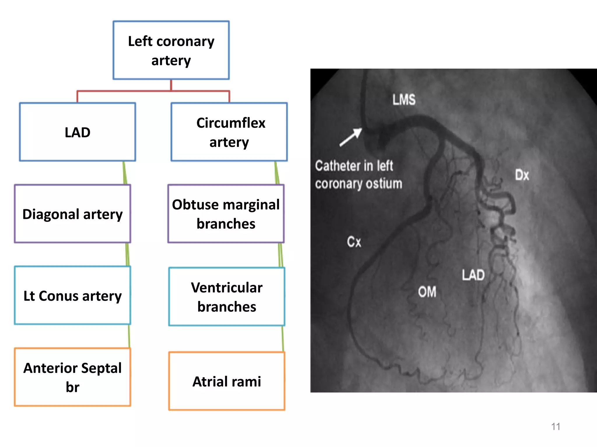Coronary angiography | PPTX
