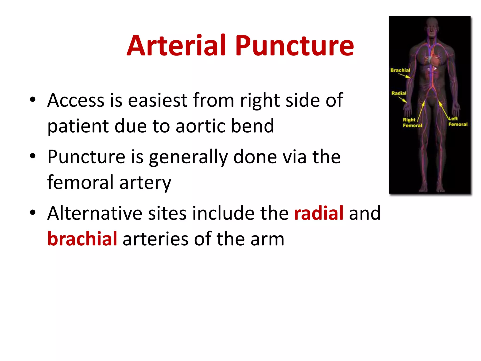 Coronary angiography | PPTX