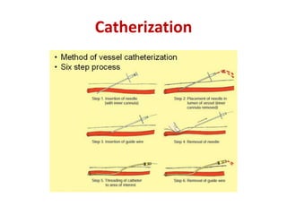Coronary angiography | PPTX
