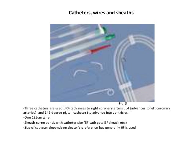 Coronary angiography