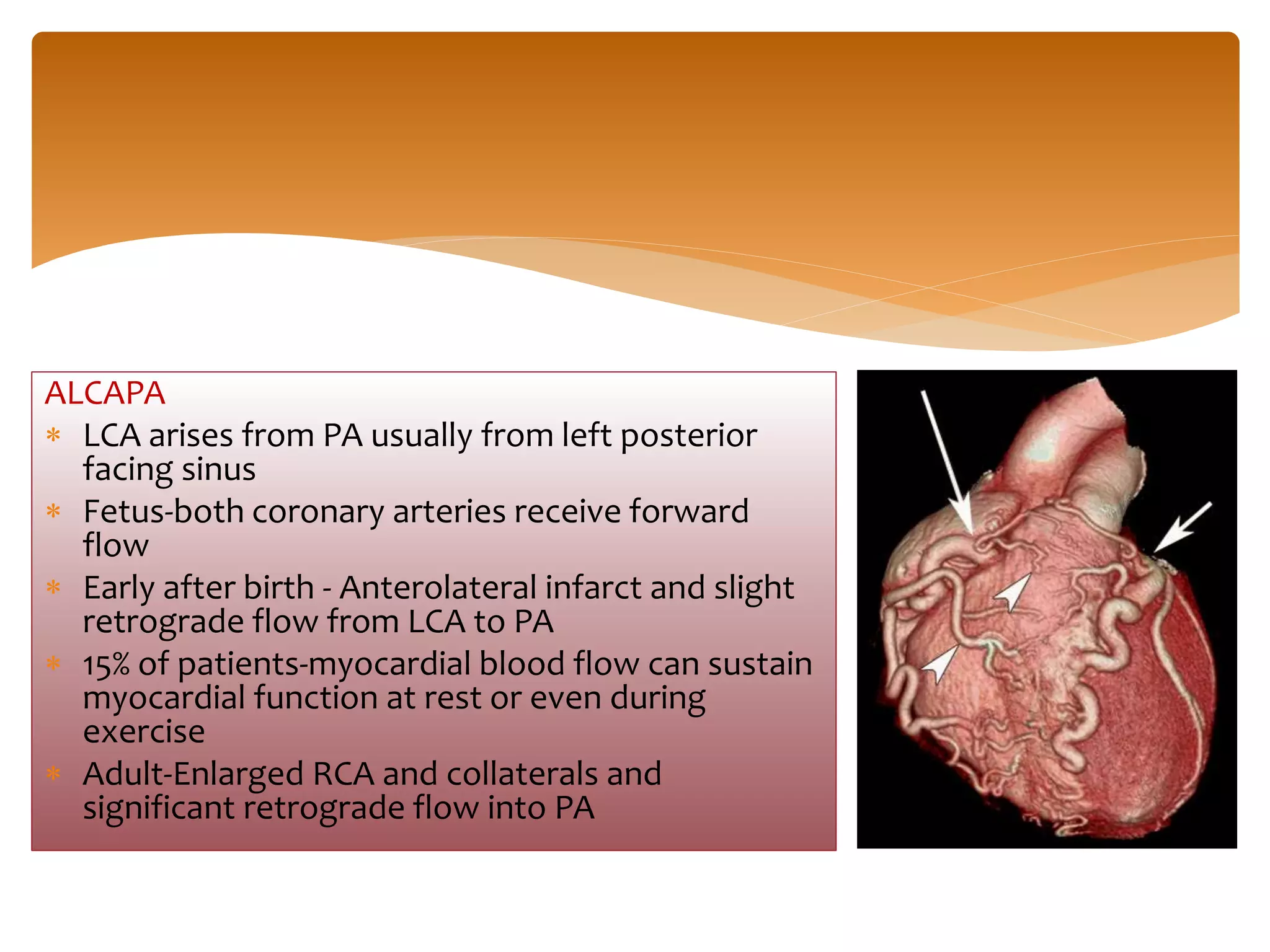 Coronary anomalies | PPTX