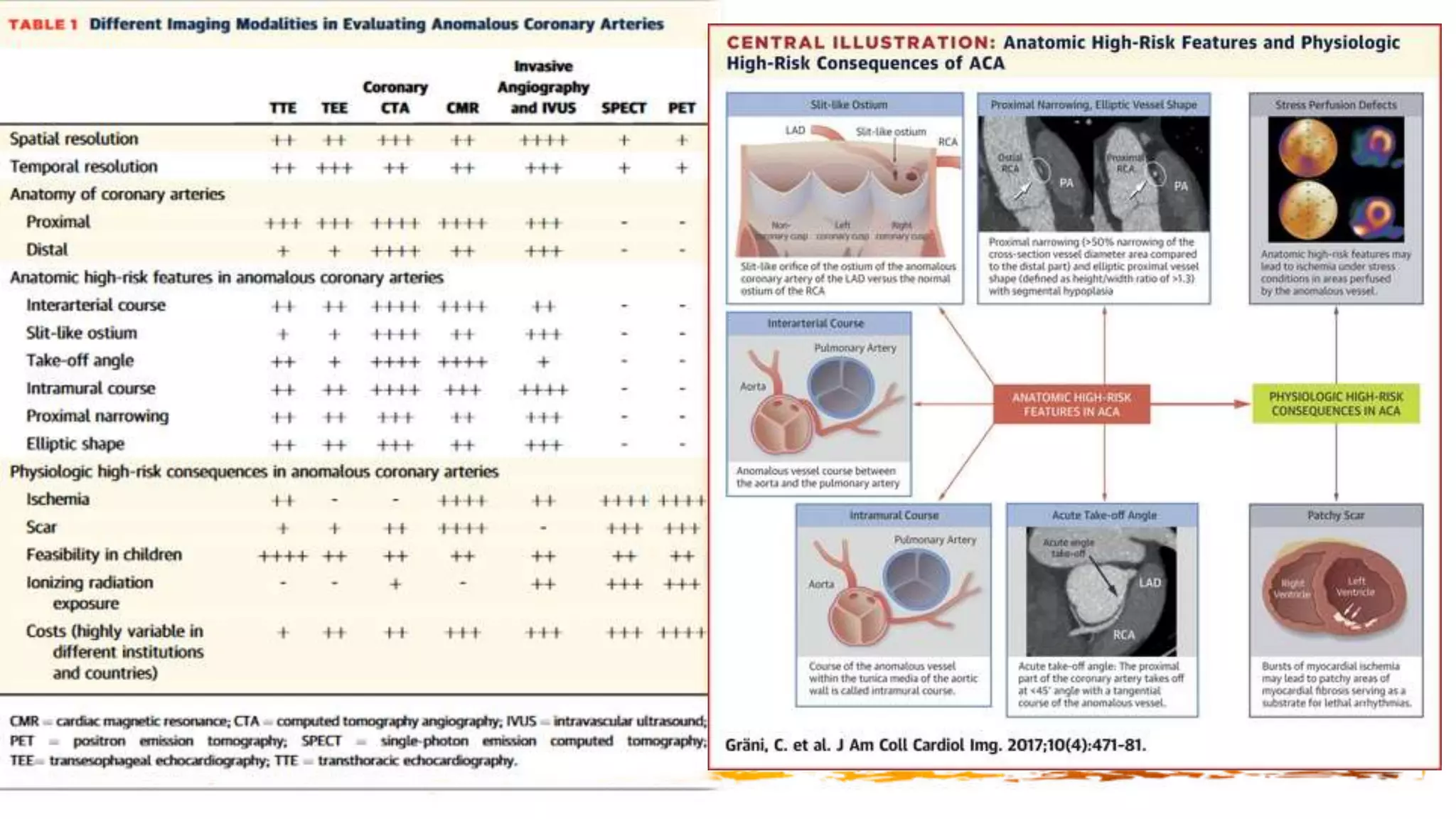 Coronary anomalies | PPTX