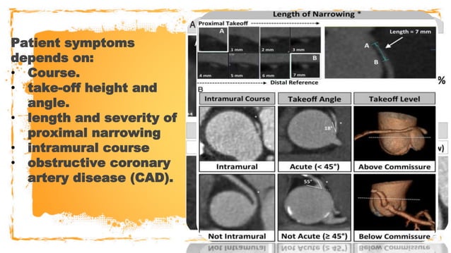 Coronary anomalies | PPT