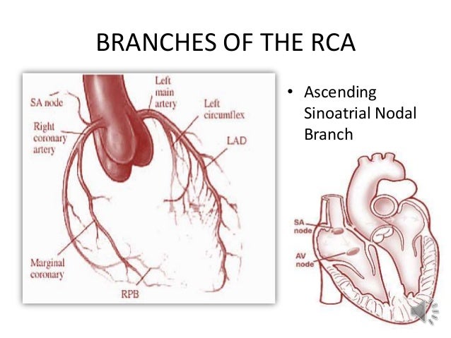 Coronary arteries