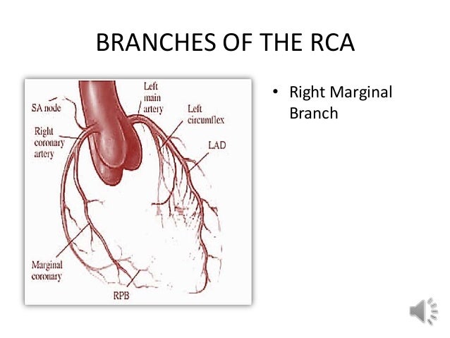 Coronary arteries