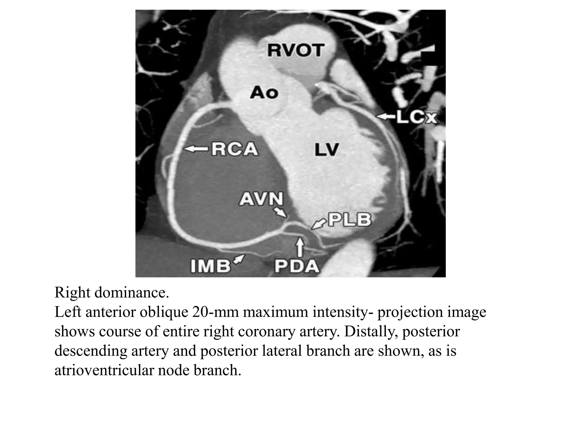 Coronary artery anatomy | PPTX