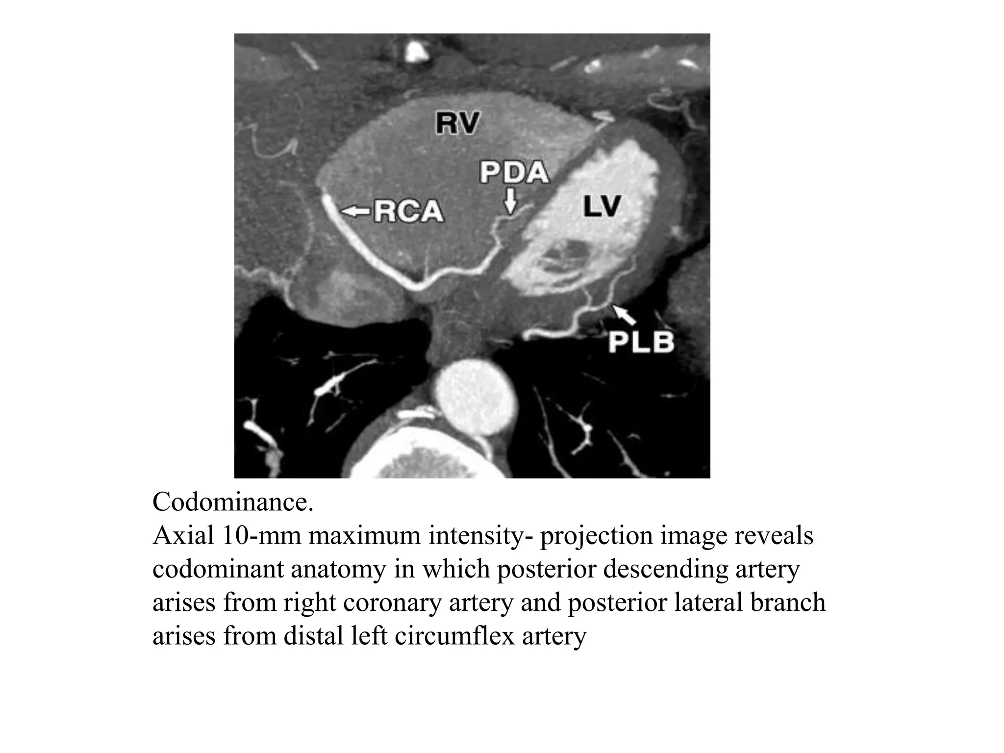 Coronary artery anatomy | PPTX