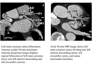 Coronary artery anatomy | PPTX