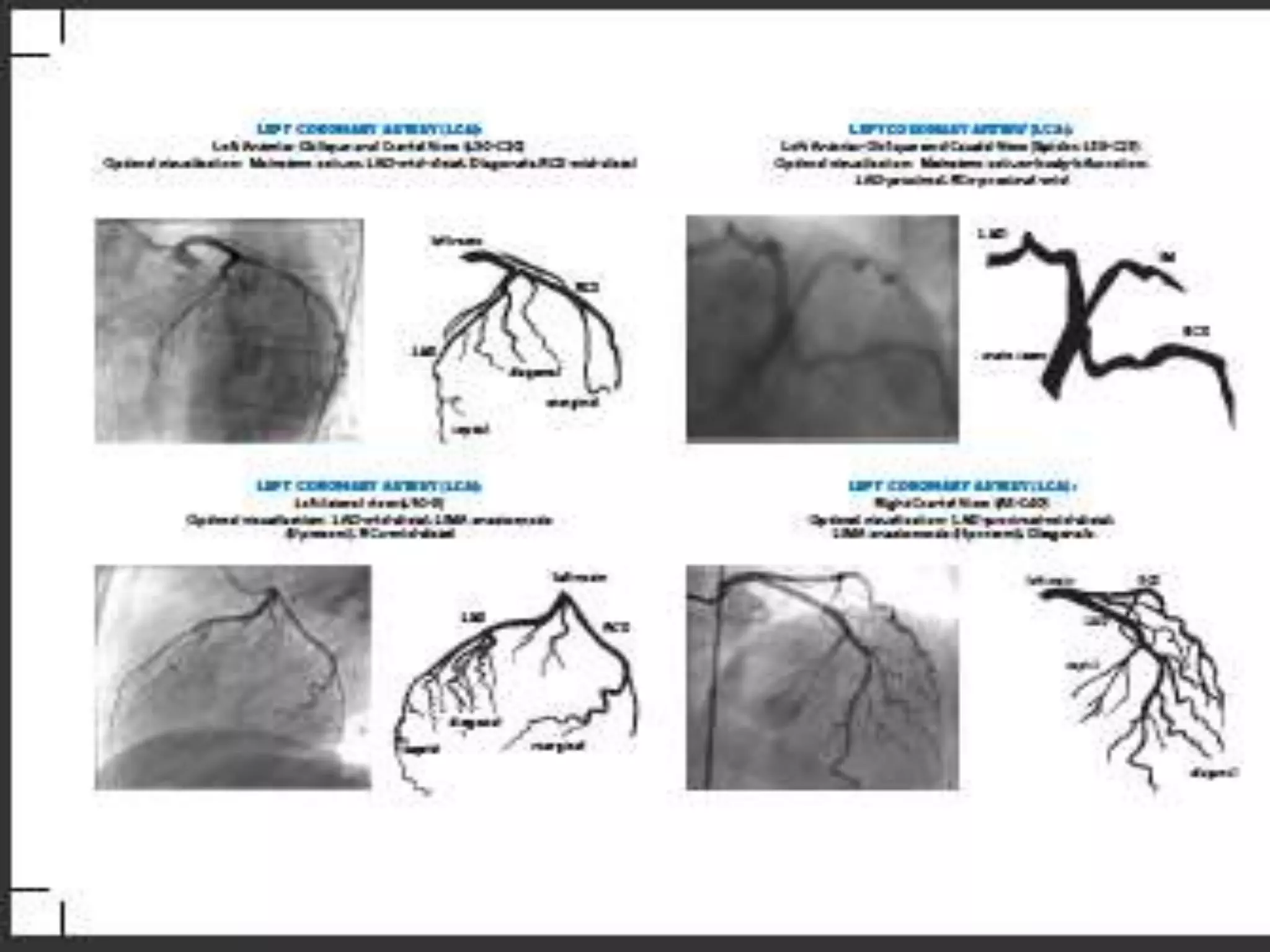 coronary artery angiography.ppt