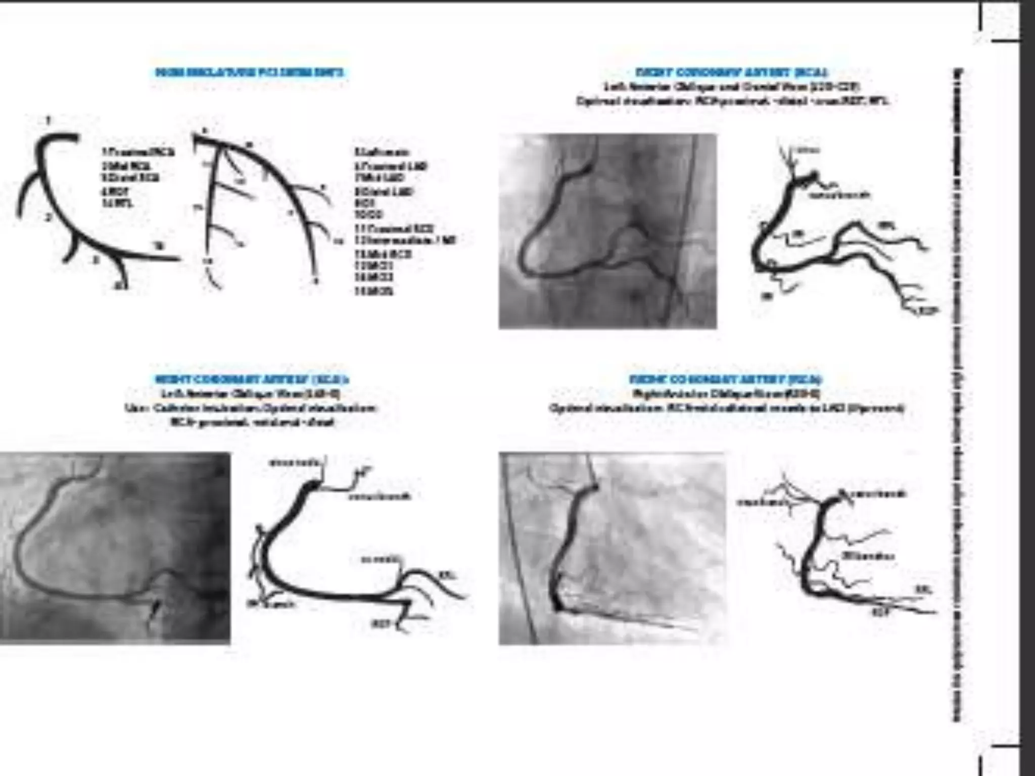coronary artery angiography.ppt