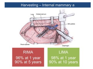 Coronary artery by pass graft | PPTX