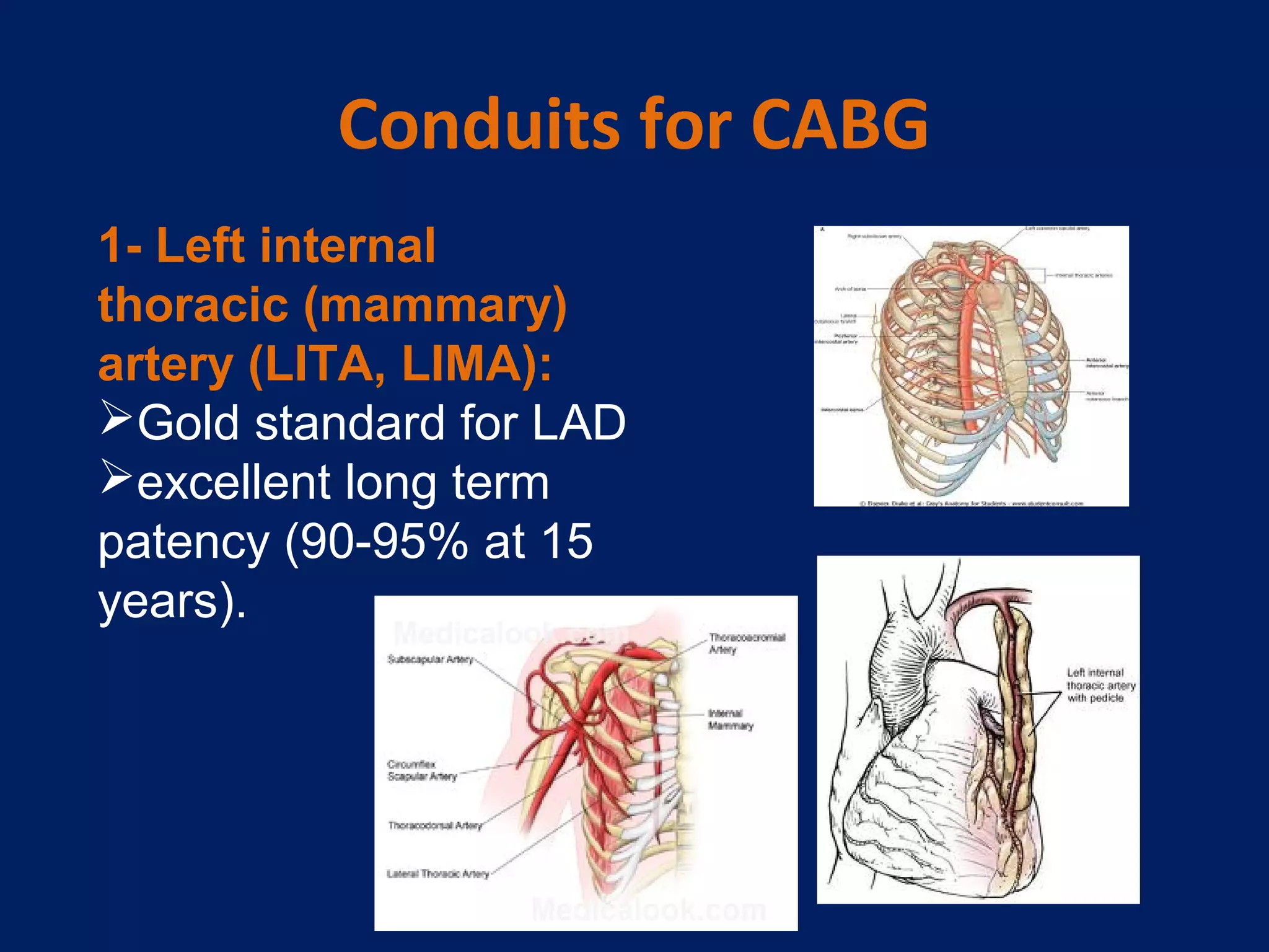 Coronary Artery Bypass Graft (CABG) Surgery | PPT