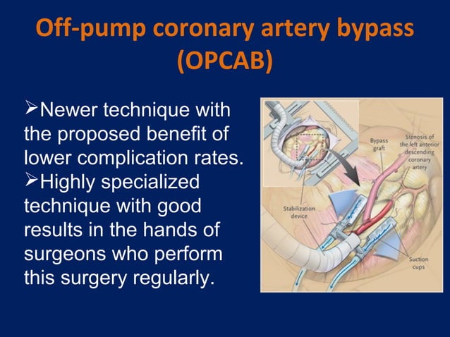 Coronary Artery Bypass Graft (CABG) Surgery | PPT