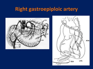 Coronary Artery Bypass Graft (CABG) Surgery | PPT