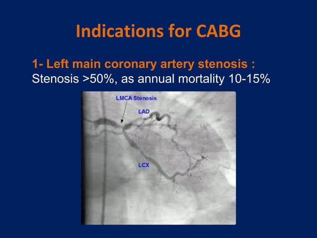 Coronary Artery Bypass Graft (CABG) Surgery | PPT