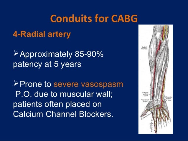 Coronary Artery Bypass Graft (CABG) Surgery