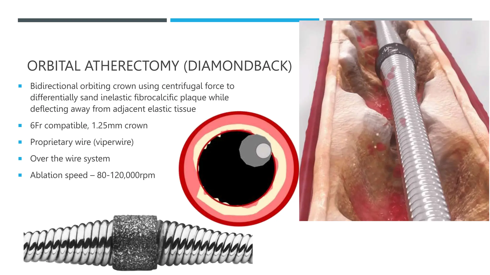 coronary artery calcification.pptx