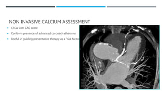 coronary artery calcification.pptx