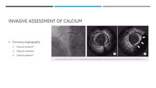 coronary artery calcification.pptx