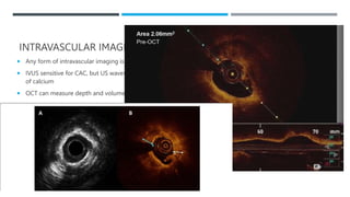 coronary artery calcification.pptx