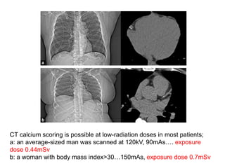 Coronary artery calcium scoring IDoR 2018 | PDF