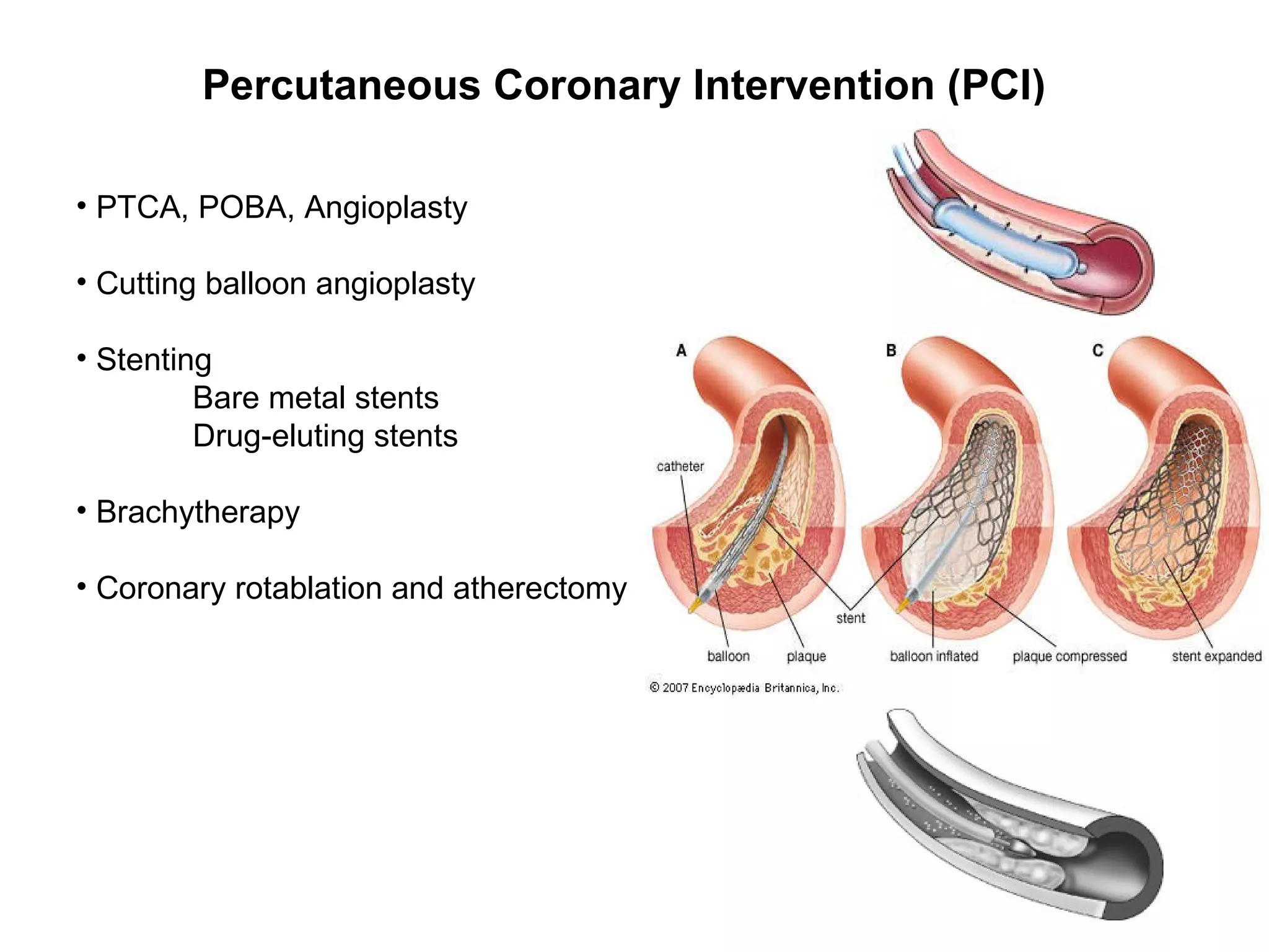 Pathophysiology of Coronary Artery Disease | PPT