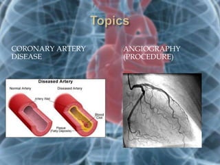 Coronary artery disease presentation | PPT
