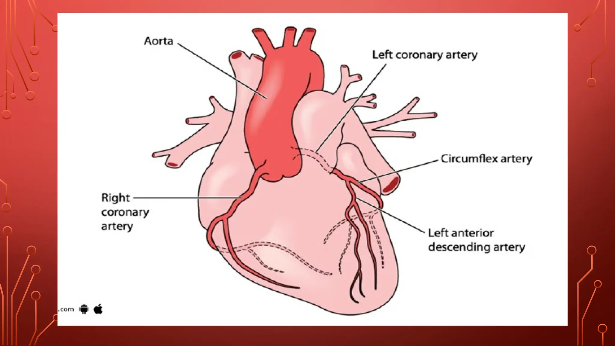 Coronary Artery Disease.pptx Coronary artery disease (CAD) involves impairment of blood flow ...