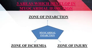 Coronary artery diseases | PPTX