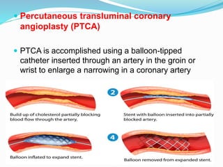 coronaryarterydiseases-210917145218.pdf