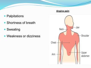 Coronary artery diseases. | PPTX