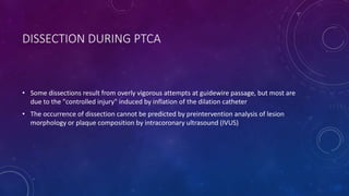 Coronary artery dissection | PPTX
