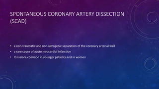 Coronary artery dissection | PPTX