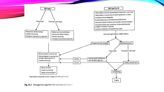 Coronary artery perforation | PPTX