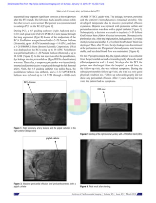 Coronary artery perforation during percutaneous coronary | PDF