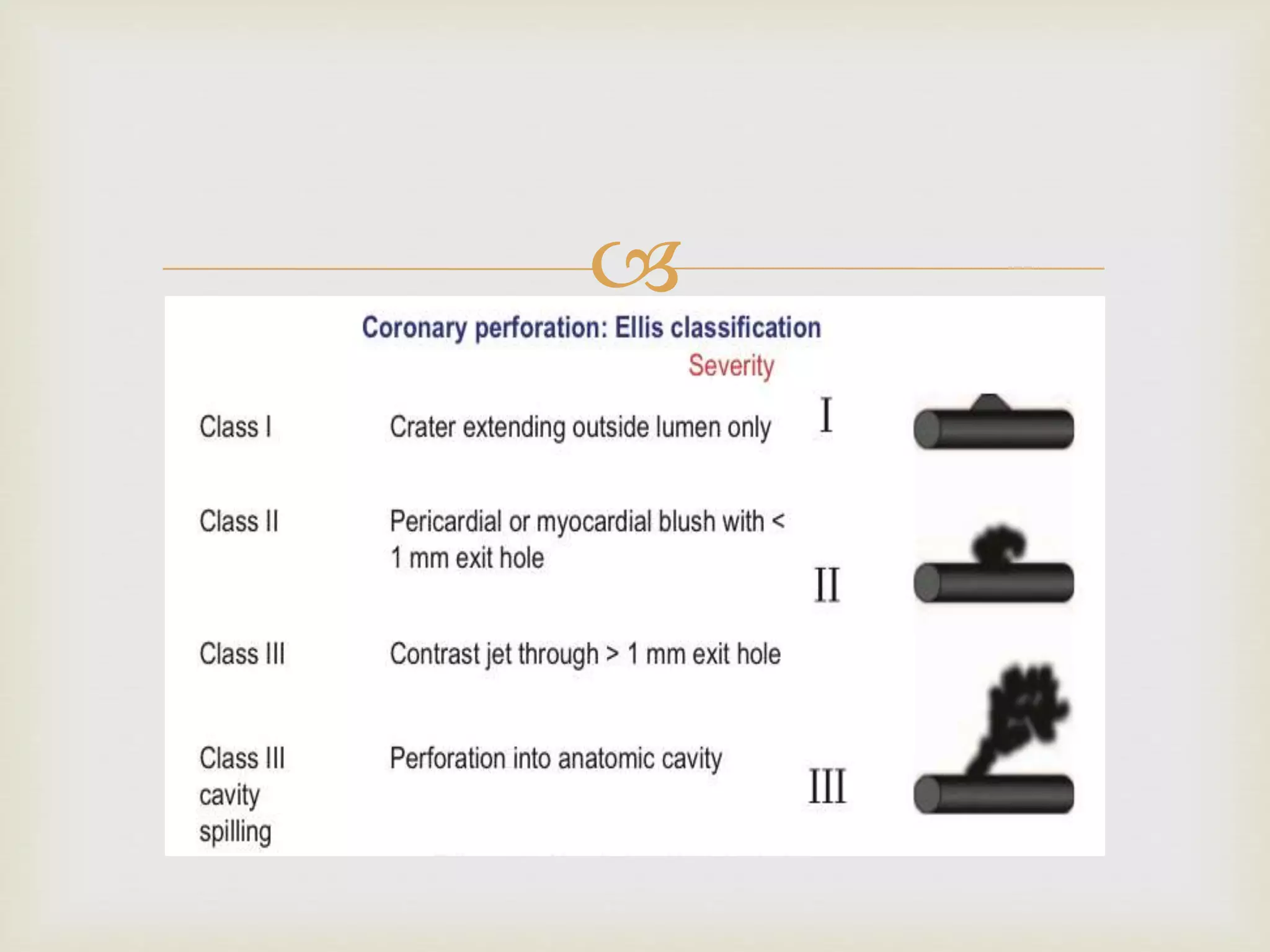 CORONARY ARTERY PERFORATIONS ppt.pptx