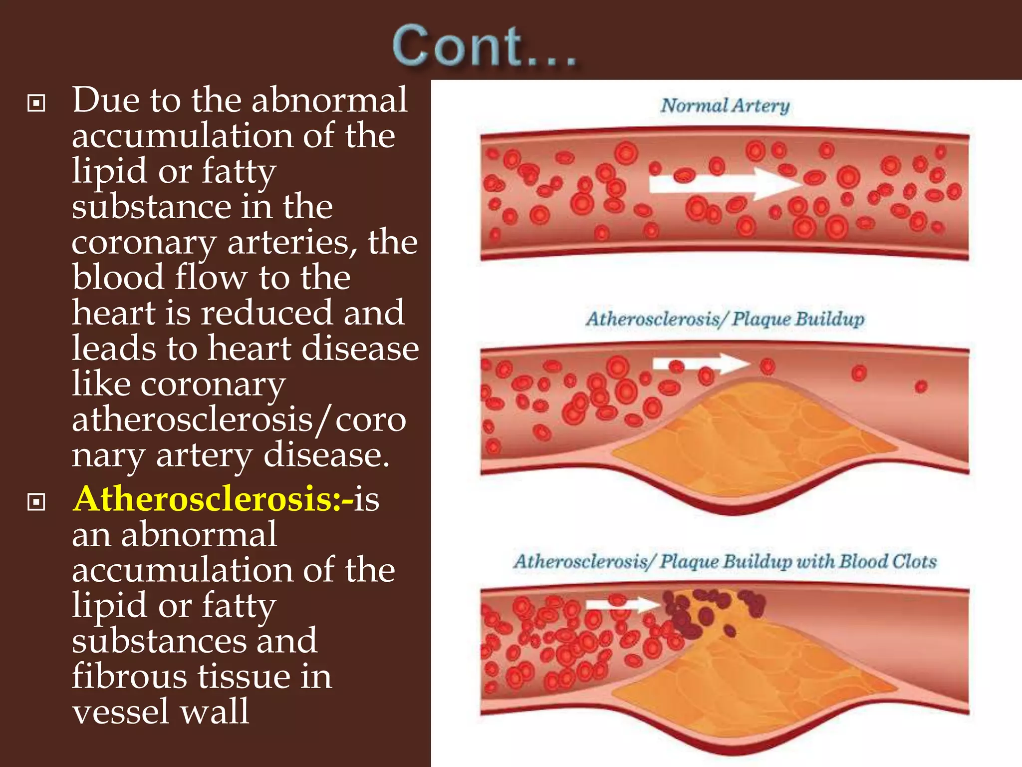 Coronary Atherosclerosis OR Coronary artery disease (CAD).pptx