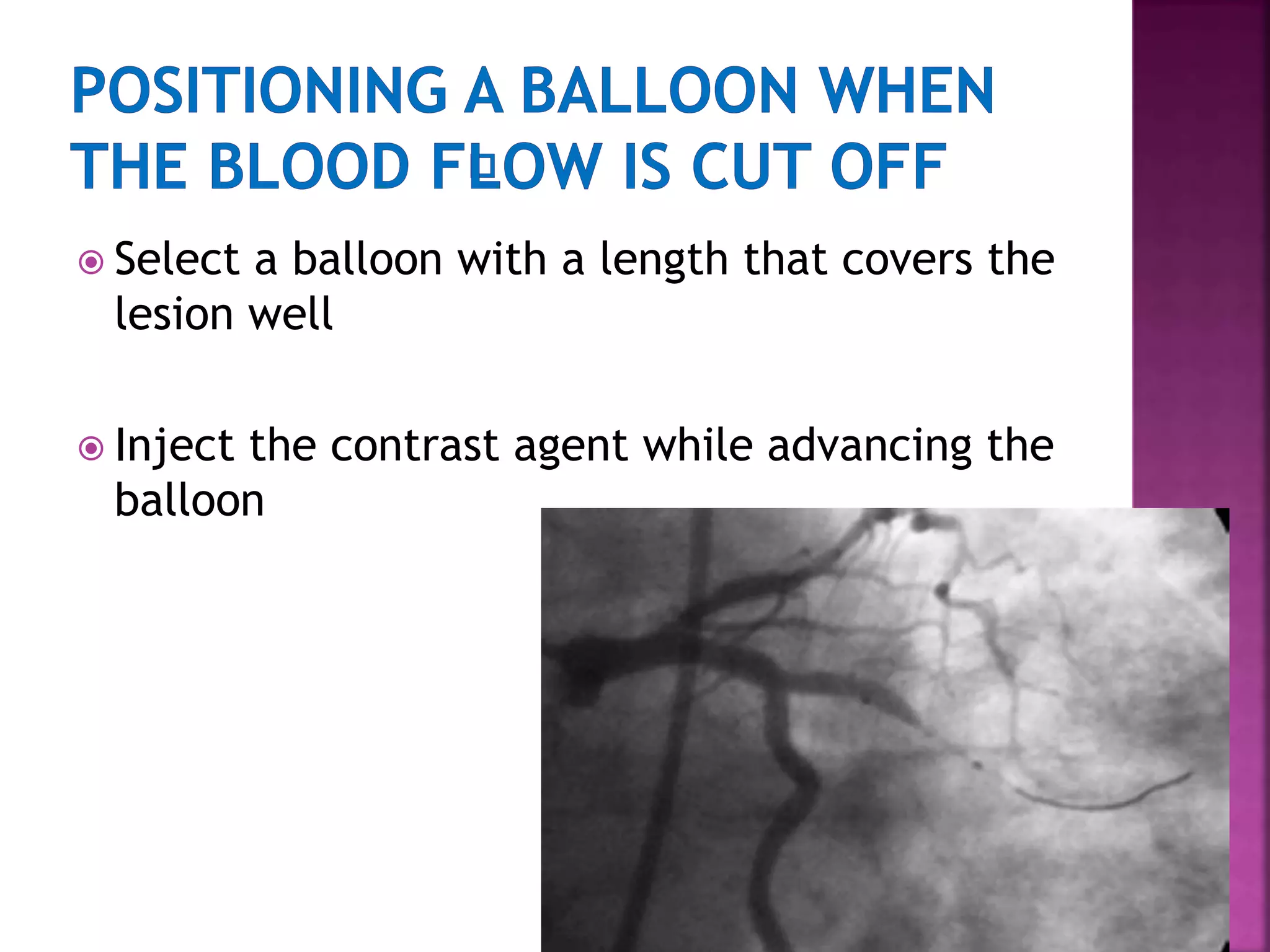 CORONARY BALLOONS PRACTICAL ASPECTS.pptx