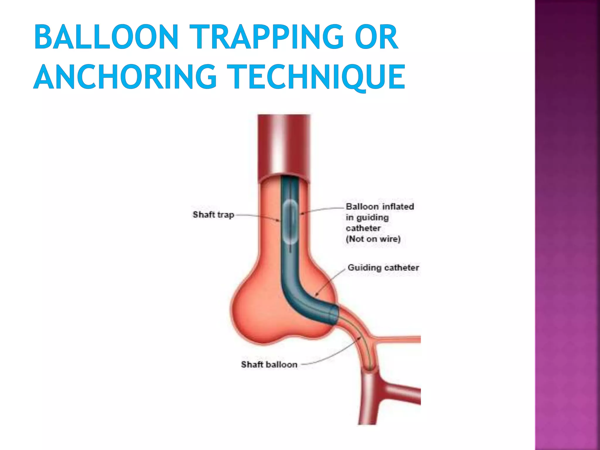 CORONARY BALLOONS PRACTICAL ASPECTS.pptx