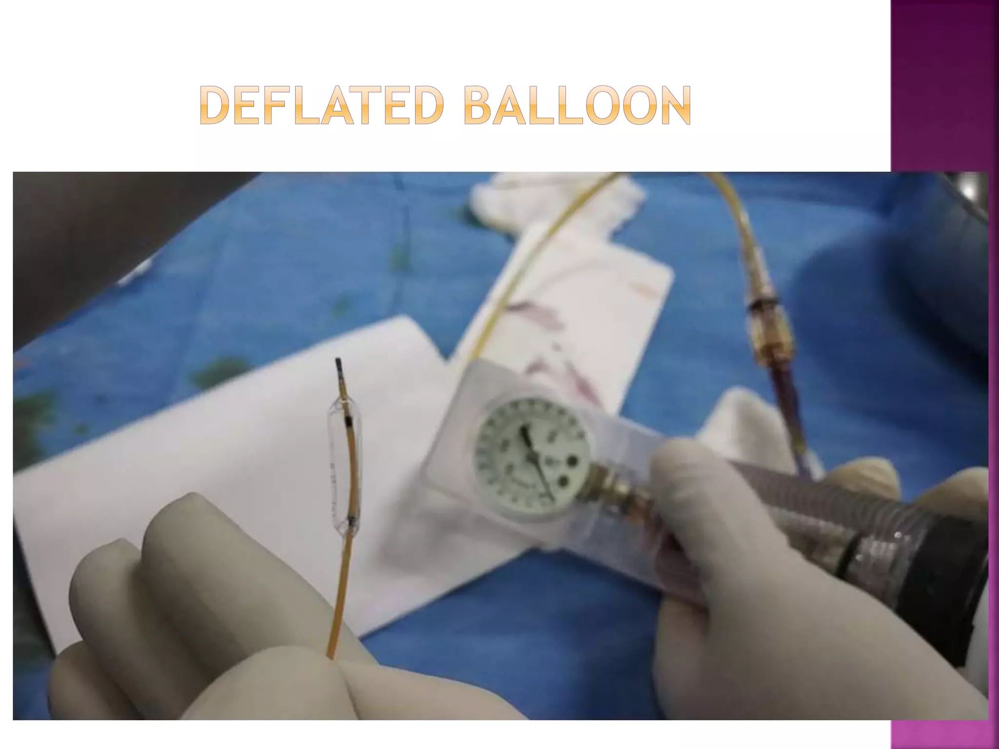 CORONARY BALLOONS PRACTICAL ASPECTS.pptx