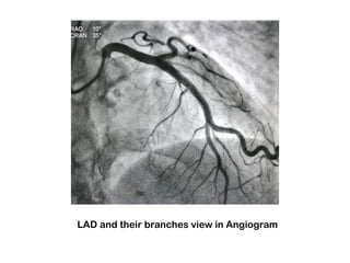 Coronary circulation - LAD, LCX and RCA.pptx