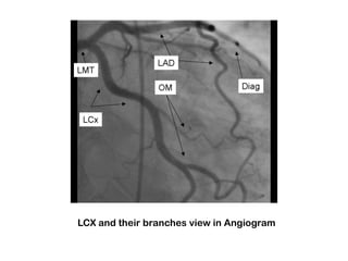 Coronary circulation - LAD, LCX and RCA.pptx