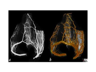Coronary circulation - LAD, LCX and RCA.pptx