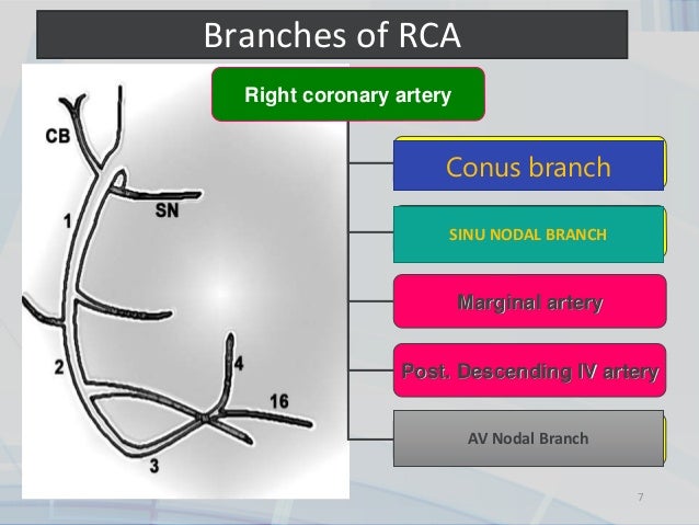 Coronary CT