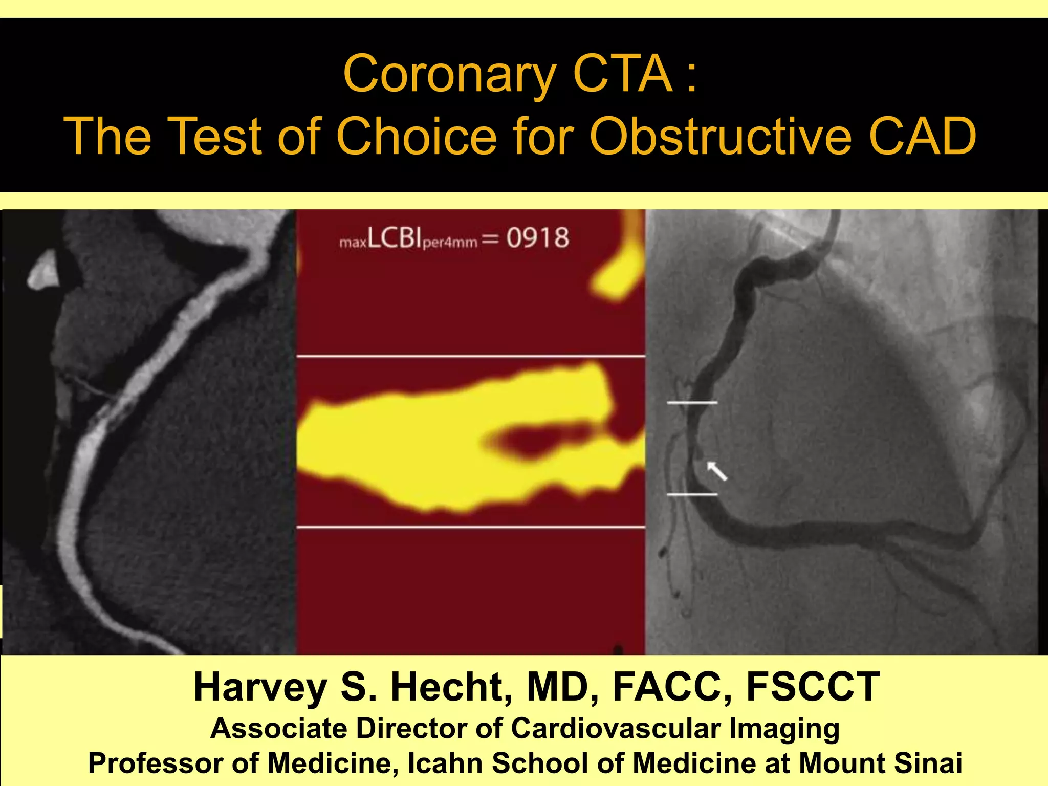 Coronary CTA: The test of choice for obstructive CAD. | PPTX