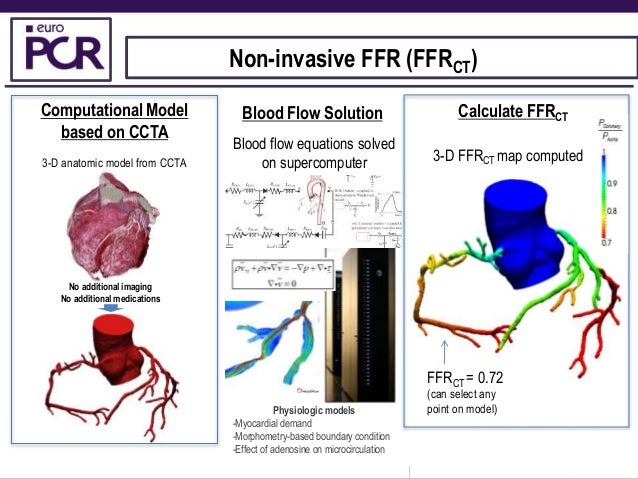 Coronary CTA: The test of choice for obstructive CAD.