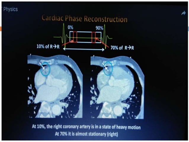 Coronary CT- angiogram: physics | PPT