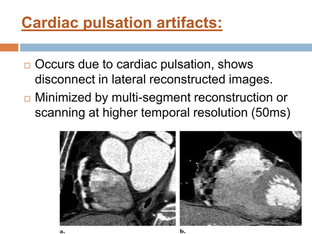 Coronary CT- angiogram: physics | PPT